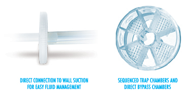 Polyp Trap – Endosurgery (ESB) – Leading distributor of endoscopic and ...